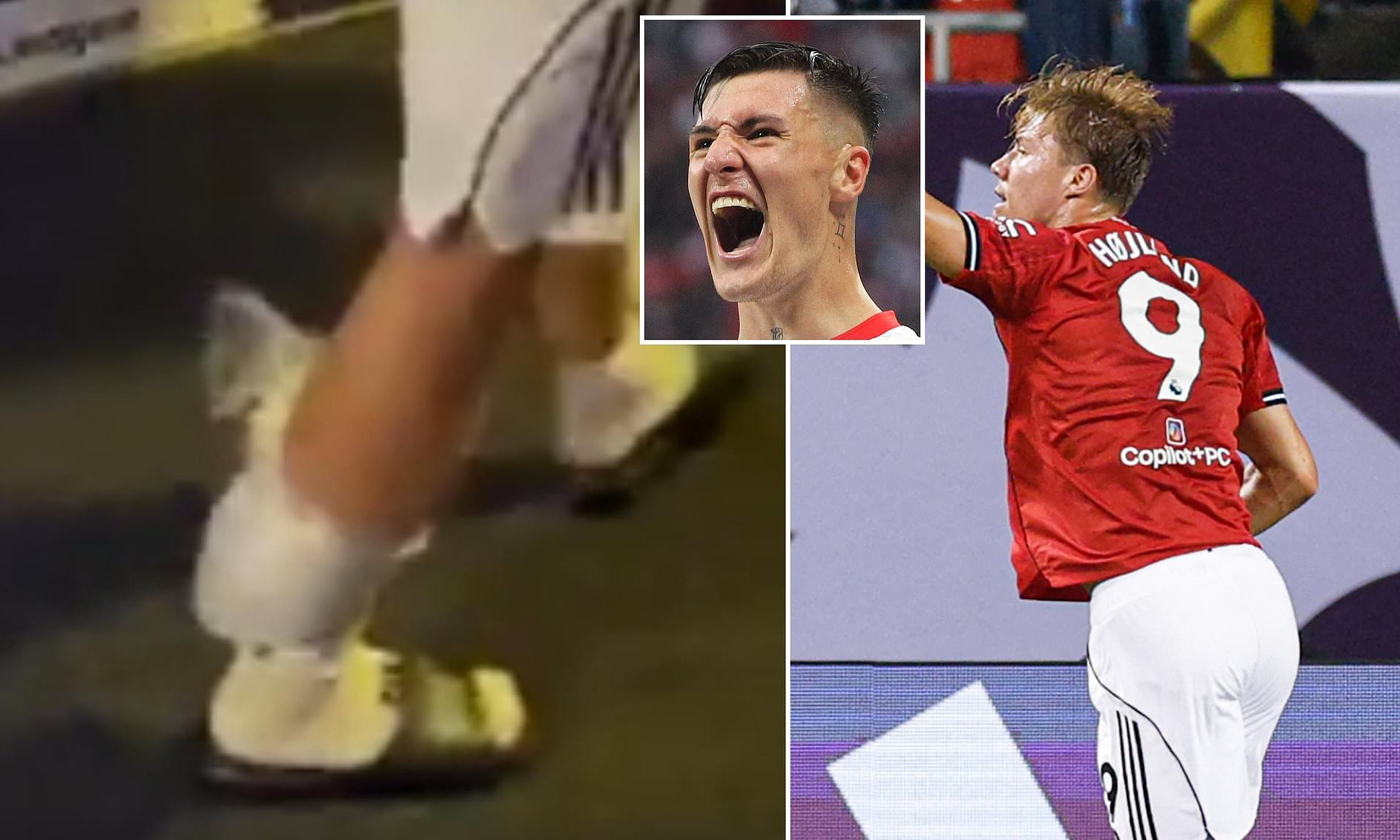 Manchester United sweat on Rasmus Hojlund fitness, as striker is seen with ice pack strapped to calf