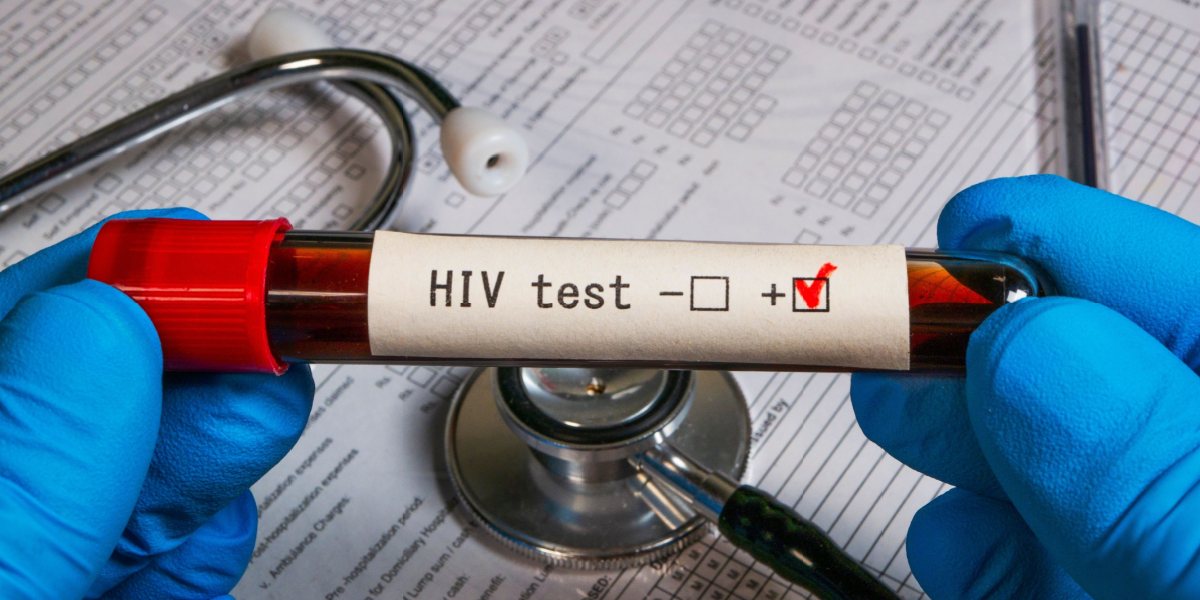 HIV infections in the Russian army up 20 times since the War in Ukraine ...