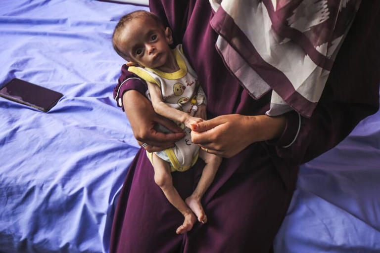 Commentary: Dying babies. Starving adults. Even Rep. Marjorie Taylor ...