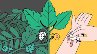 What's the Best Way to Treat a Poison Ivy Rash?