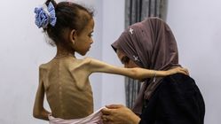 Anak di Gaza yang Viral Karena Menangis Kelaparan Ini Meninggal Dunia ...