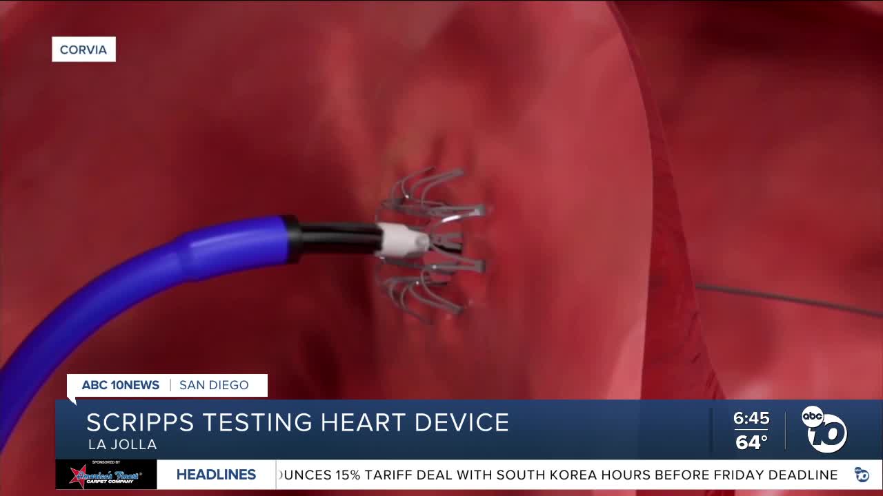 Scripps La Jolla testing new heart device that offers hope for patients ...