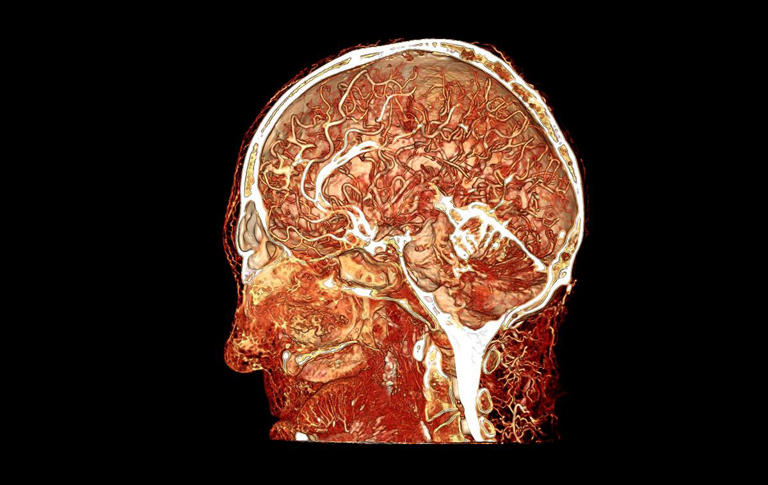 New Human “Mini-Brains” Combine Cells From The Whole Brain – Even The ...