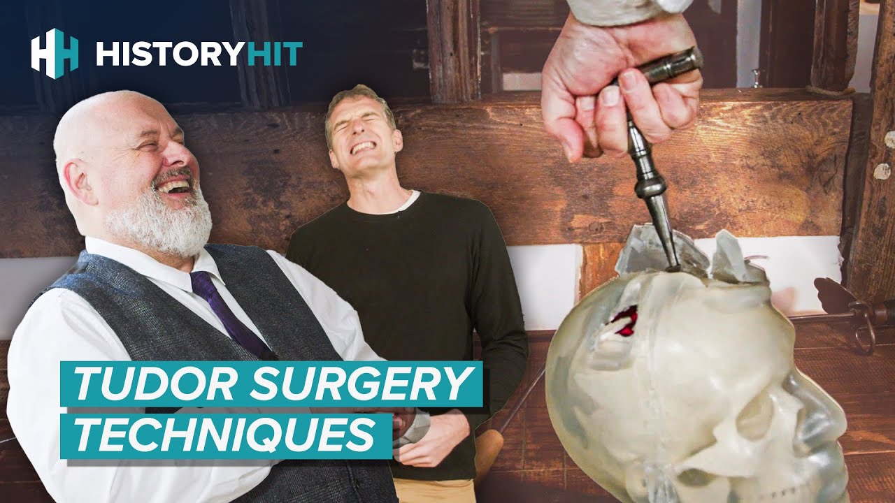 Battlefield Surgery In The Age of Gunpowder | The Gruesome History