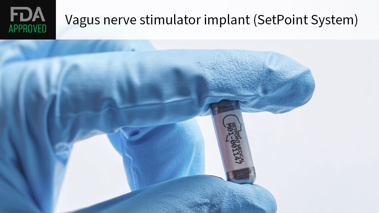 Vagus Nerve Device OK'd for Rheumatoid Arthritis