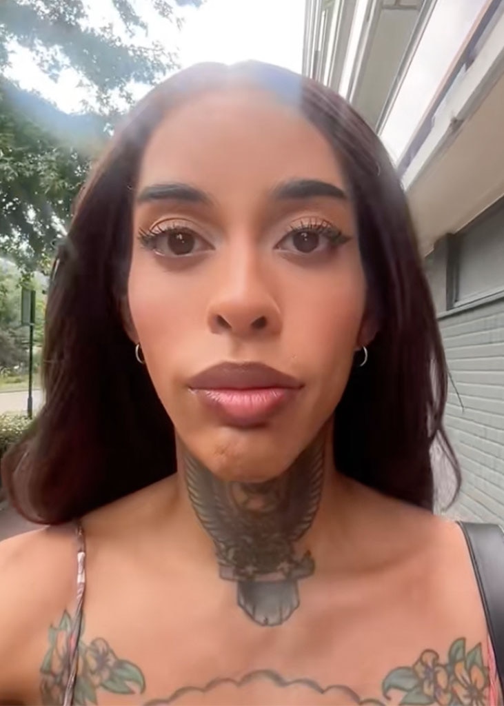 TikToker Shares Tongue-Splitting Cosmetic Procedure Results