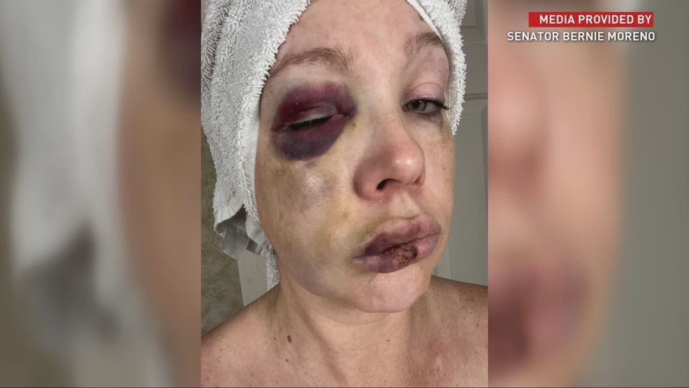 Cincinnati fight video sparks political debate, GOP senator shares ...