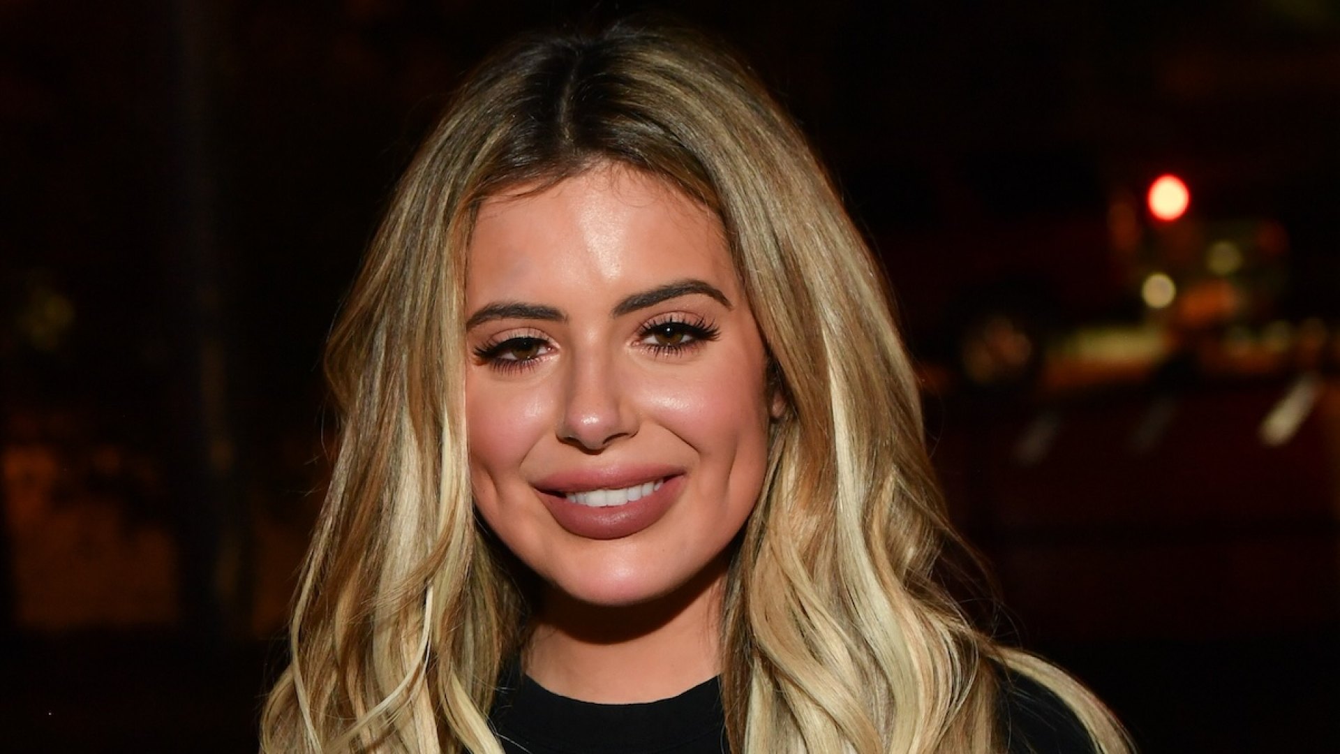 Brielle Biermann Reveals Her New Look After Dissolving Under-Eye Filler