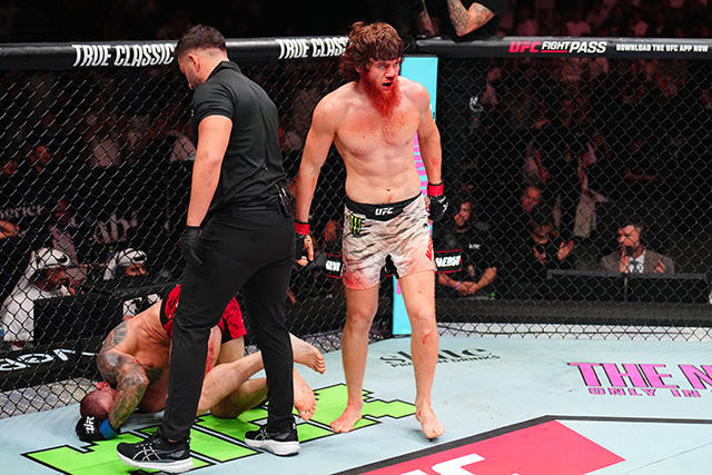 'Shara Bullet' Gives Injury Update After Suffering Broken Nose at UFC ...