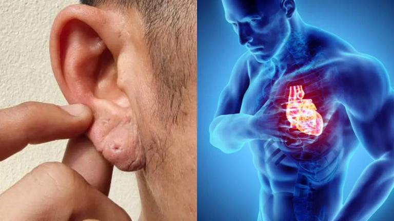 Why Does Your Body Age Faster After 50?