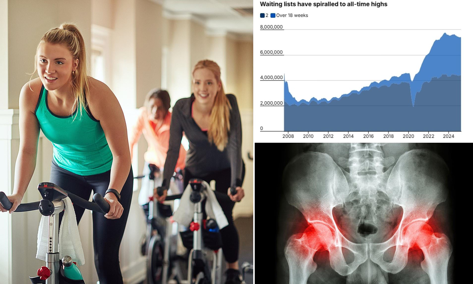 Experts pinpoint best gym class for people with common hip problem: 'It ...