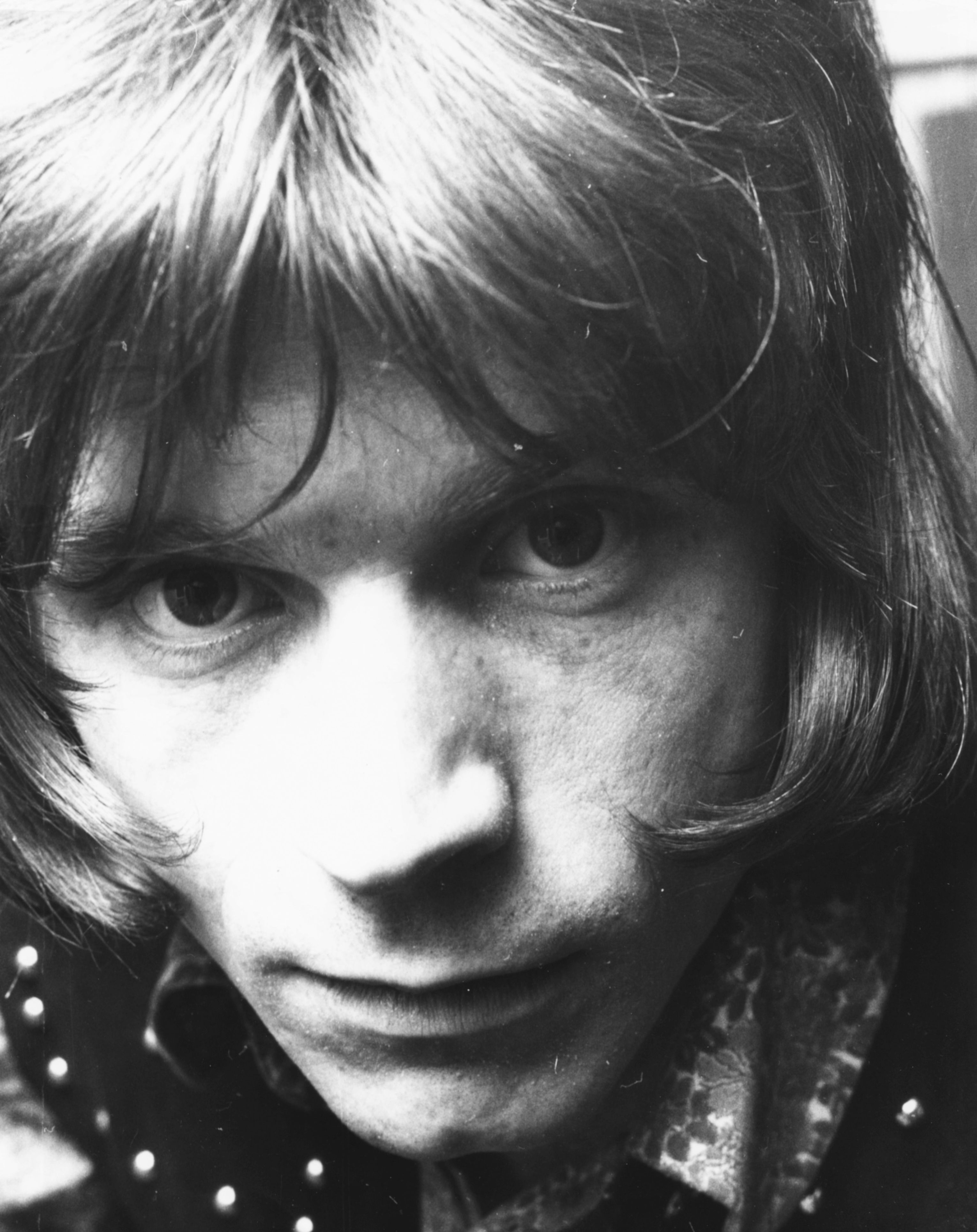 1970s rock musician Dave Edmunds critically ill in hospital after ...