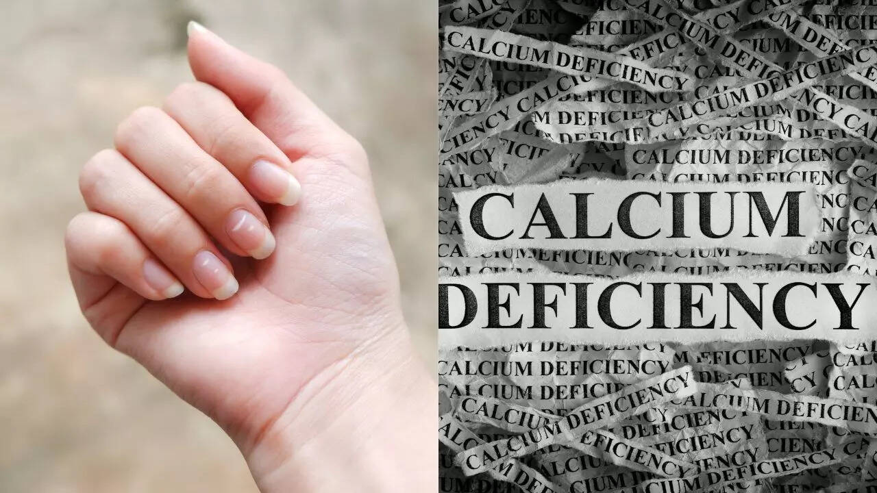 15 calcium deficiency symptoms that might go unnoticed
