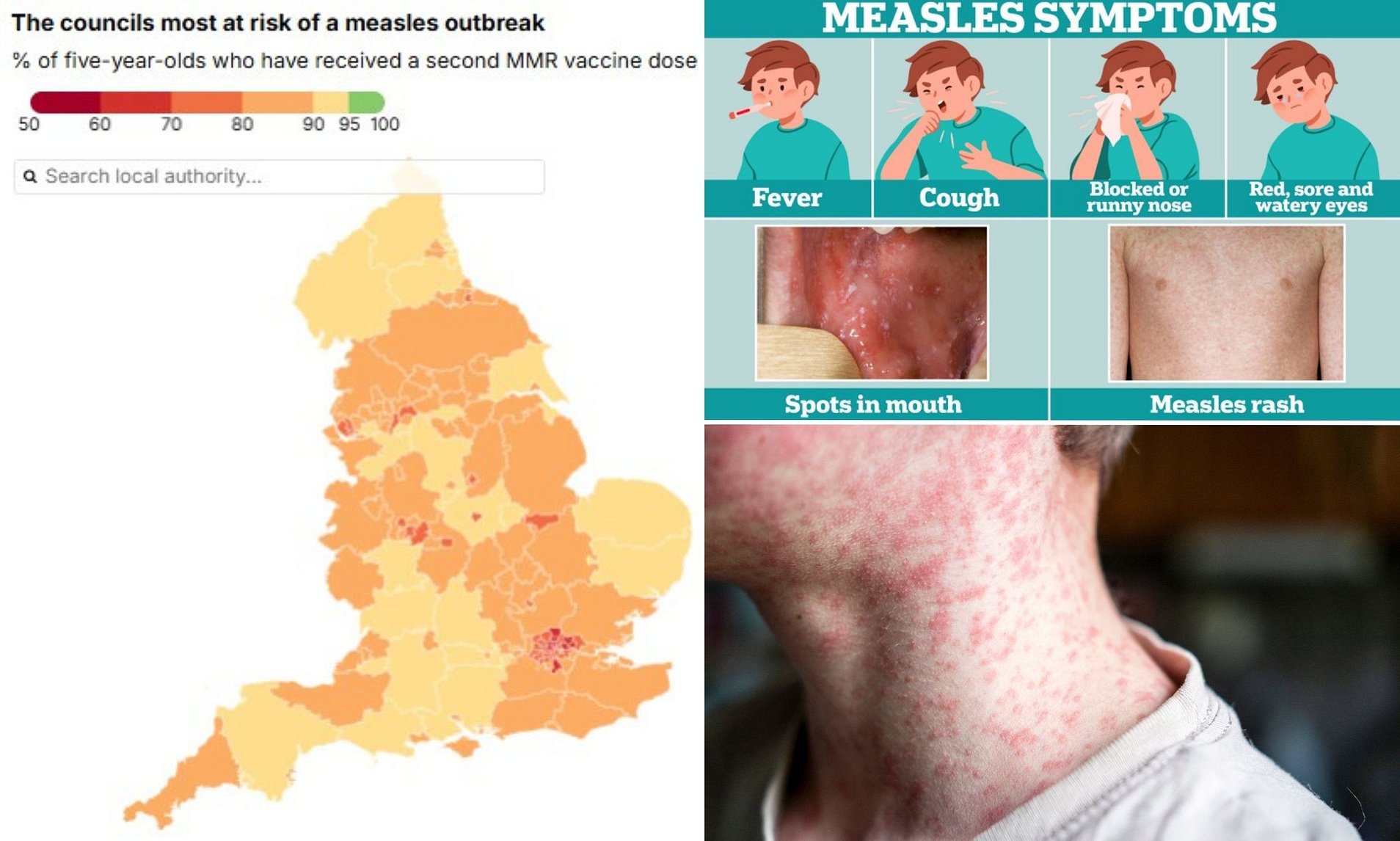 Cases of the world's most infectious disease keep climbing in UK - two ...