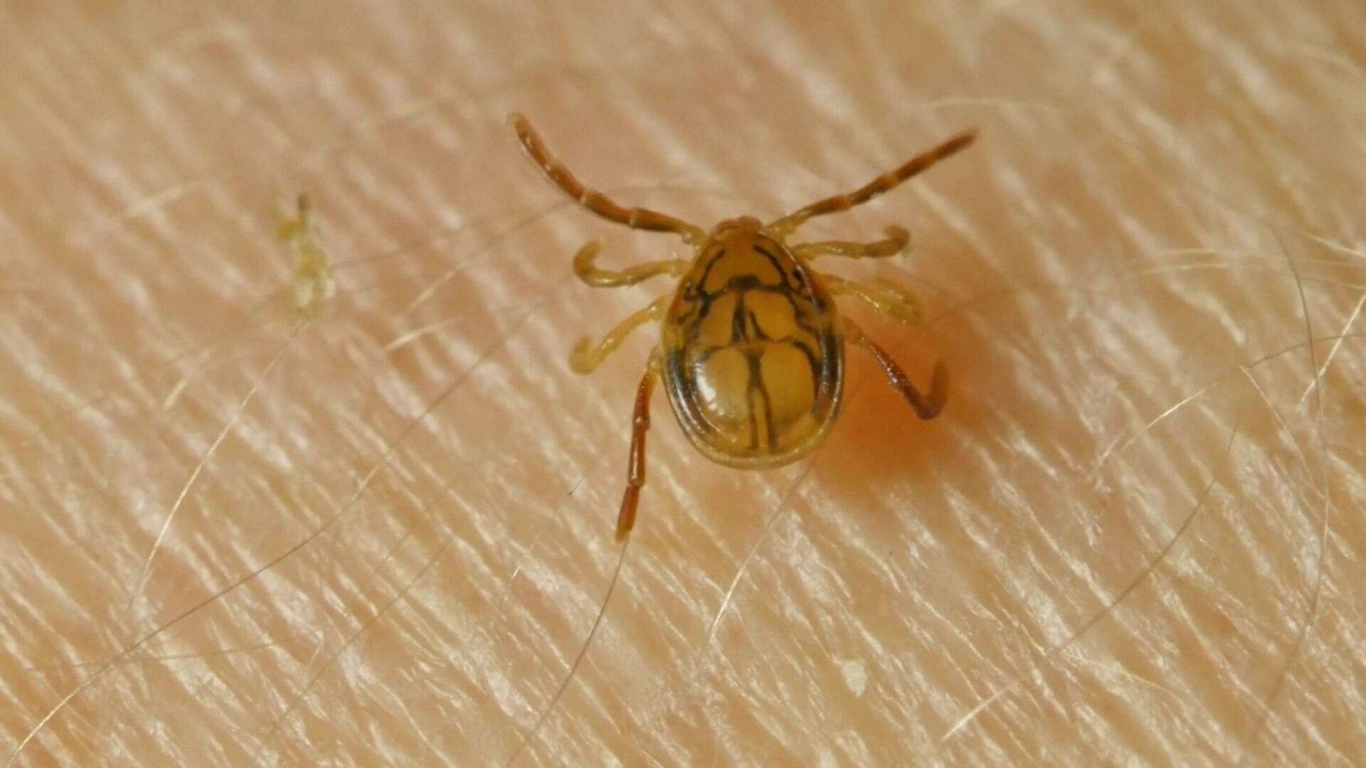 Rockford-area doctors say Lyme disease is preventable