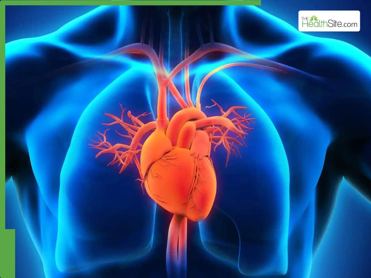 5 Health Conditions High Uric Acid Can Cause