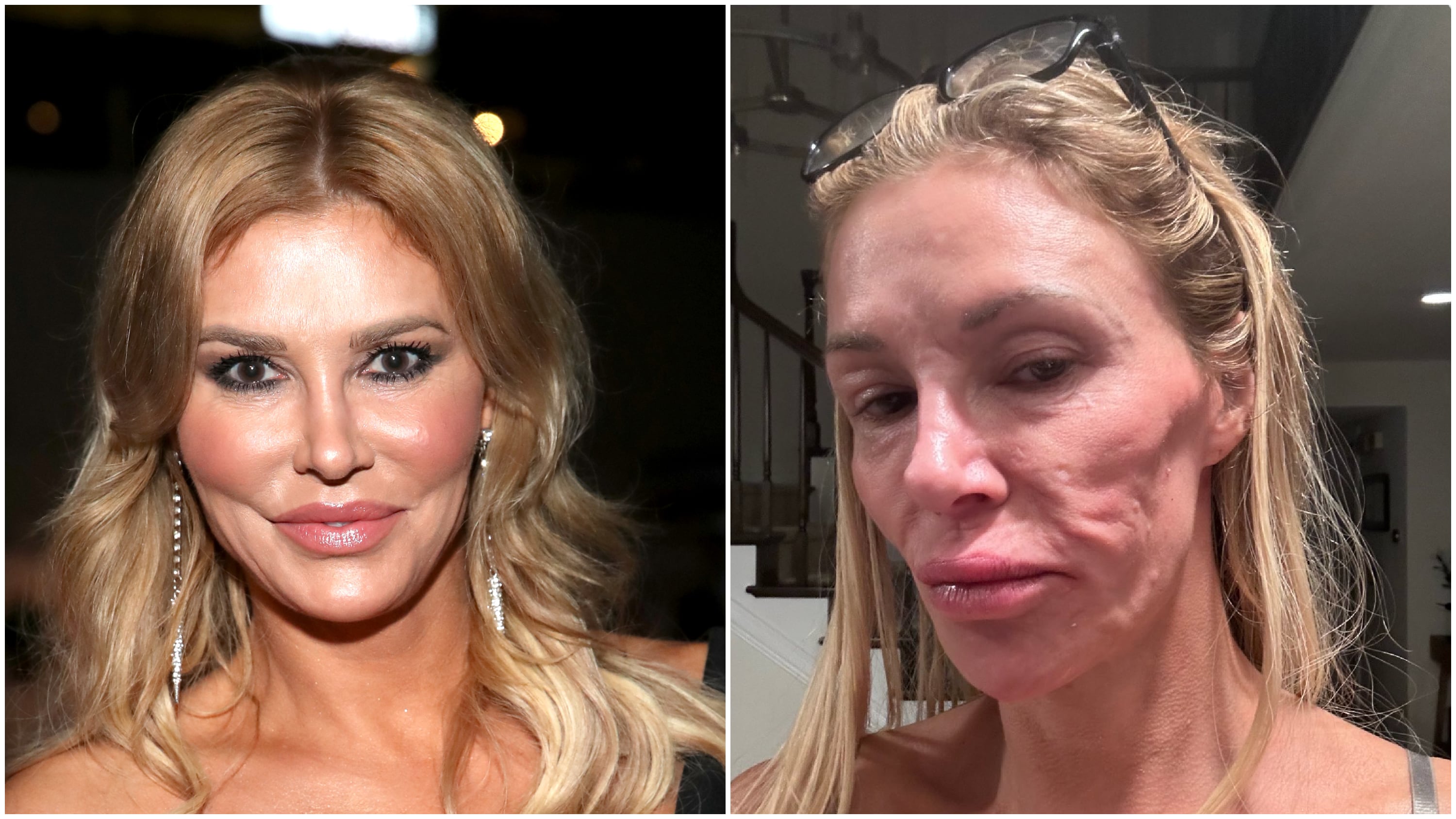 Reality Star Reports Breakthrough on Mystery Facial Paralysis