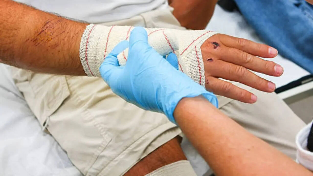 What is a Degloving Injury? Can It Be Cured?