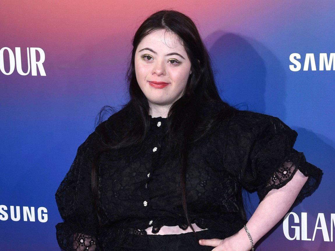 Ellie Goldstein: Vogue Model Conquers the Dance Floor