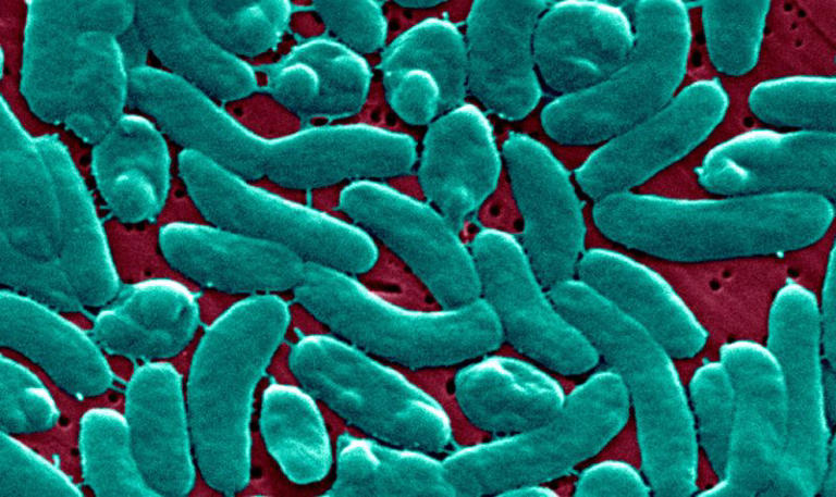 Flesh-eating bacteria: Expert tips for avoiding an infection this summer