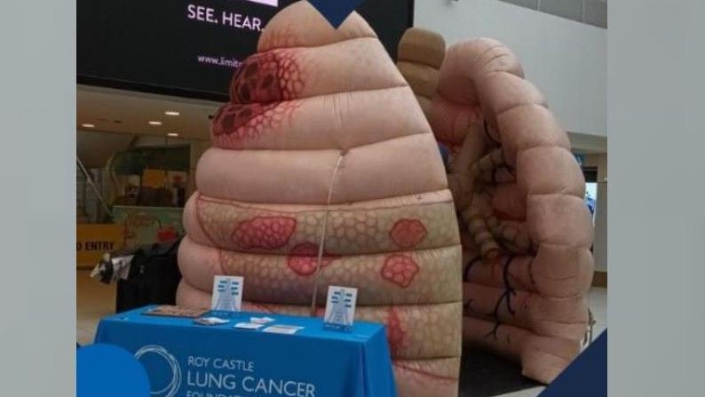 Inflatable 'mega lungs' promote cancer screening