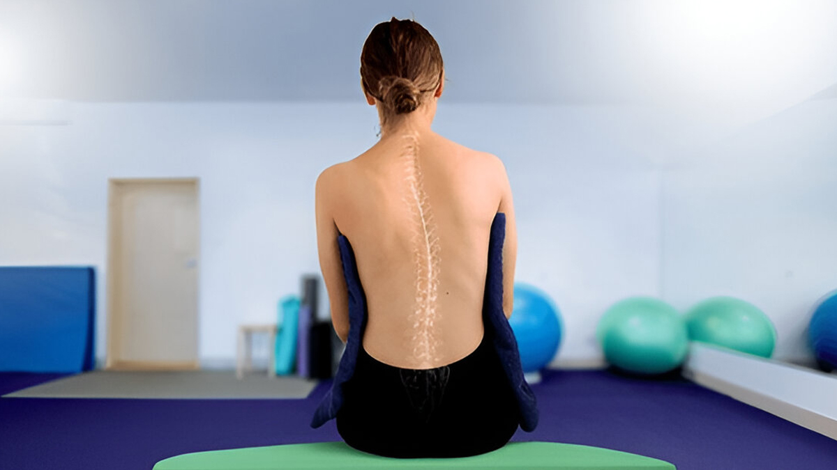Adam’s Forward Bend Test: How It Works To Detect Spine Issues In Children