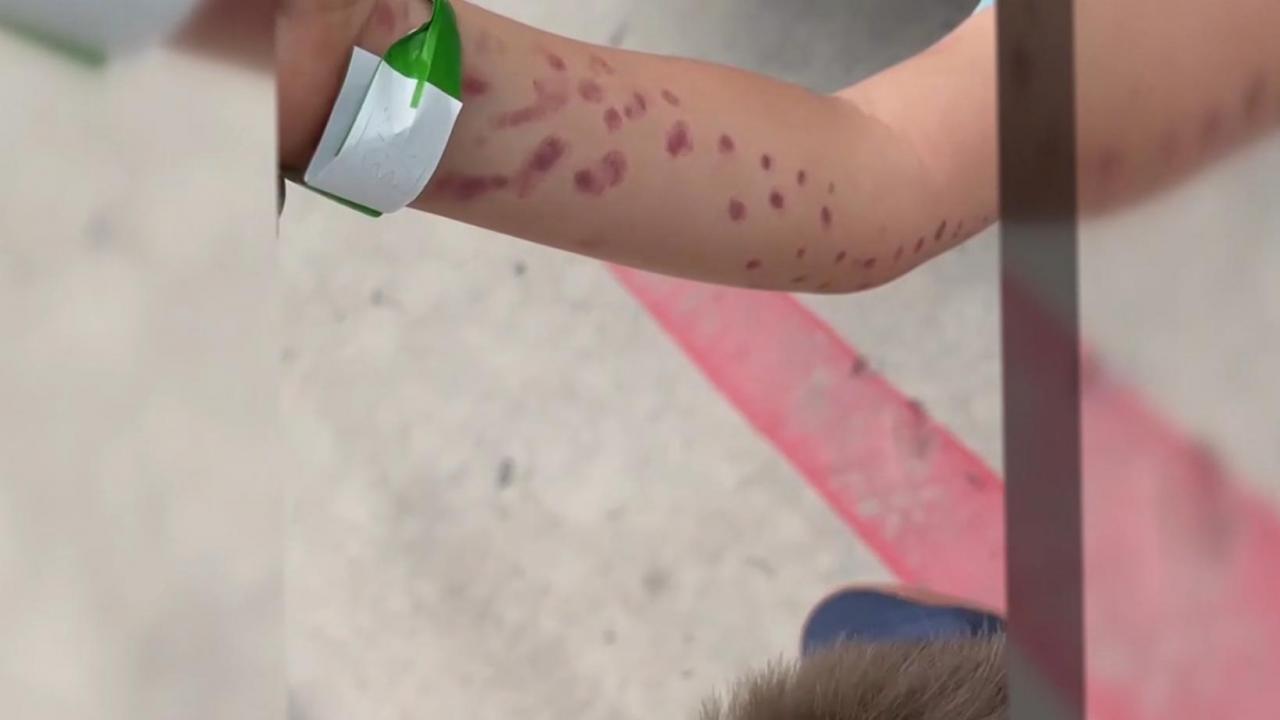 Octopus latches onto boy's arm at San Antonio Aquarium, causing bruising