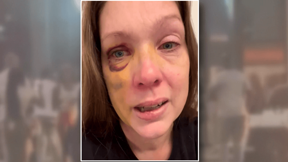 Victim speaks out after downtown Cincinnati brawl, more than $260K ...