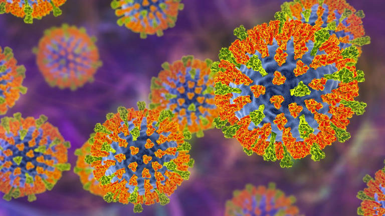 How measles surge risks long-term damage to children’s immune systems