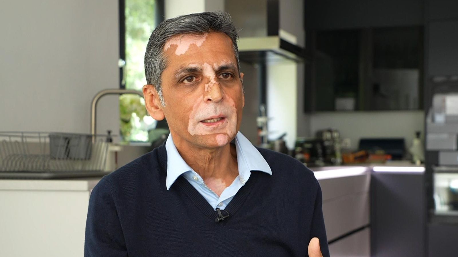 Doctor describes 'carnage' at Gaza hospital