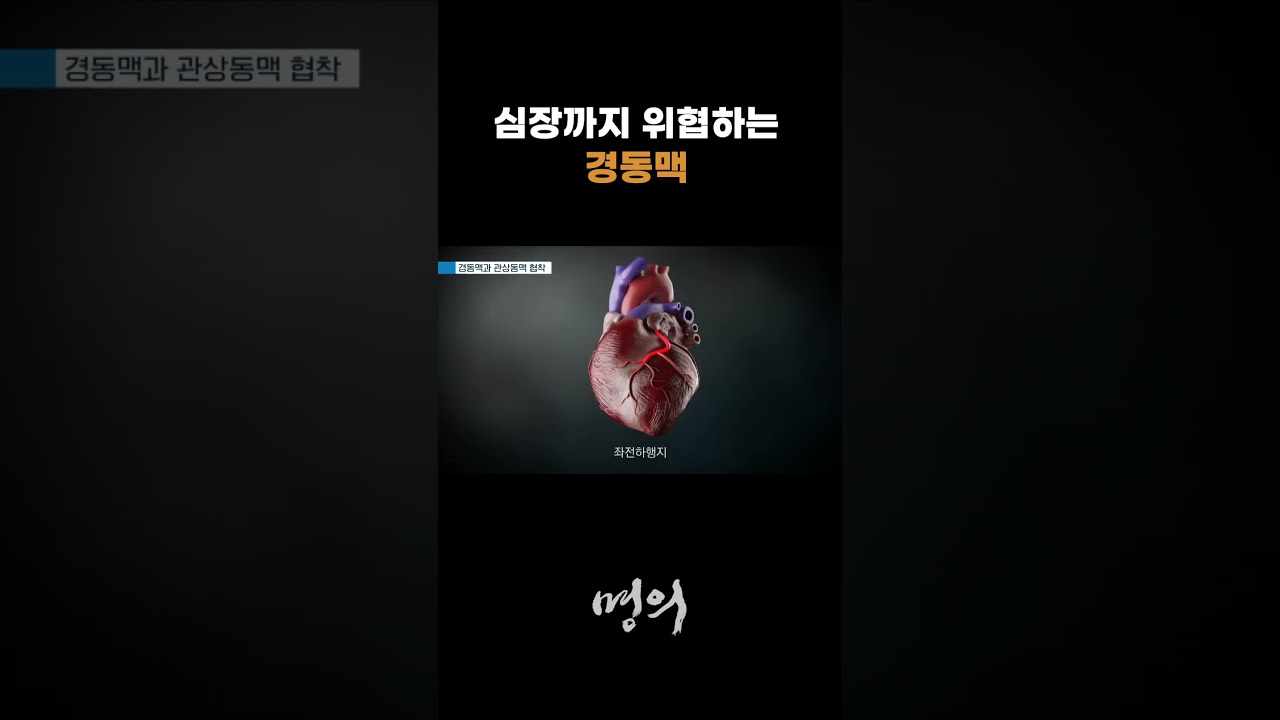 심장까지 위협하는 경동맥 #ebs건강 #ebs #건강