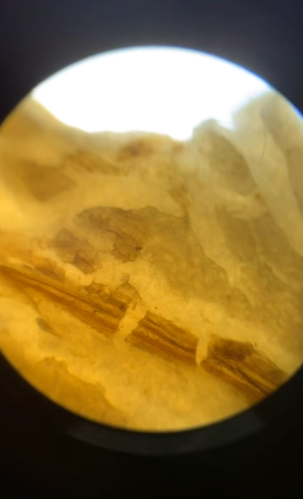 You Won’t Believe What This Looks Like Under a Microscope!