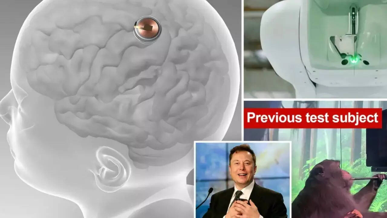 Elon Musk’s Neuralink brain chip: What is it, how it helps paralysed patients and aims to merge ...