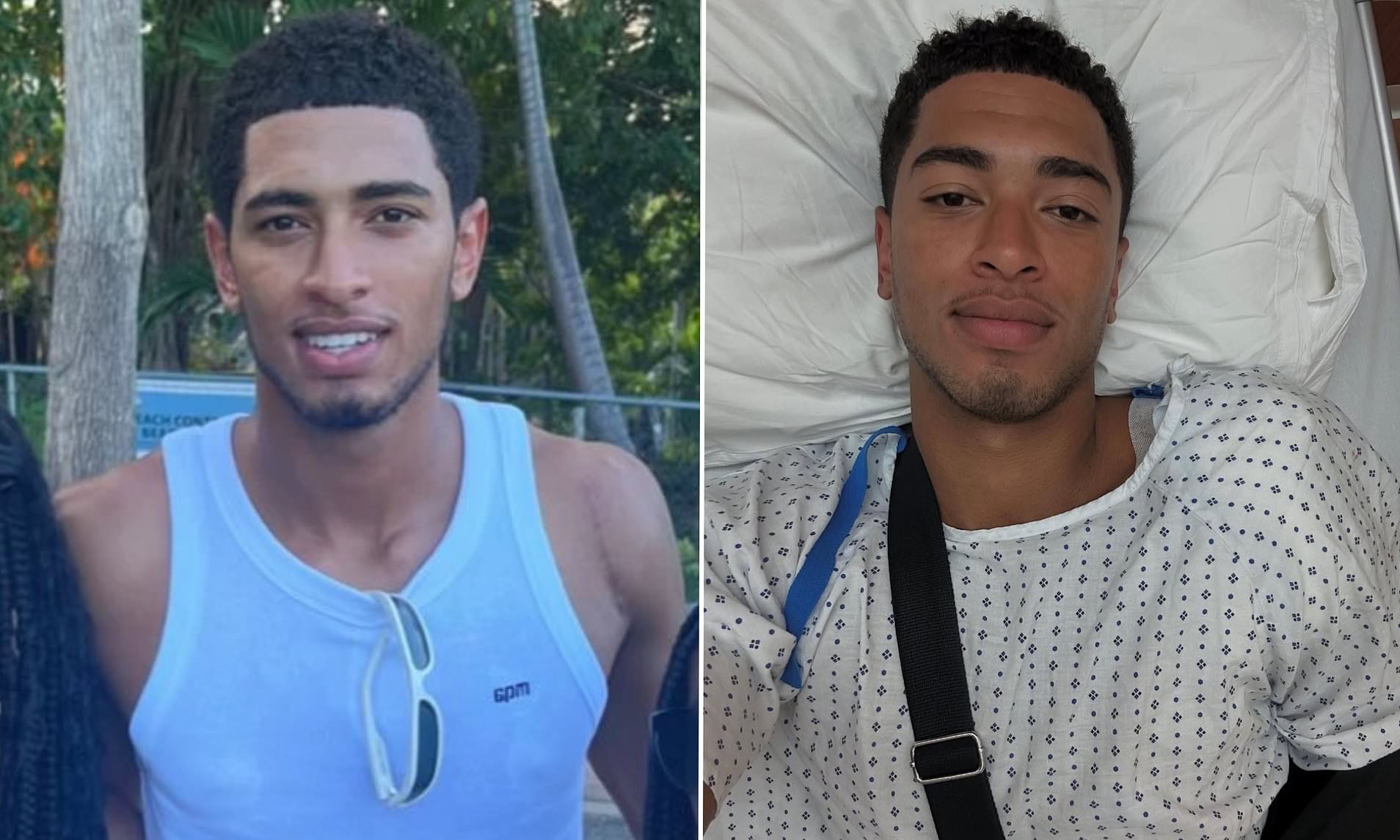 Jude Bellingham shows off massive scar after Real Madrid star underwent ...