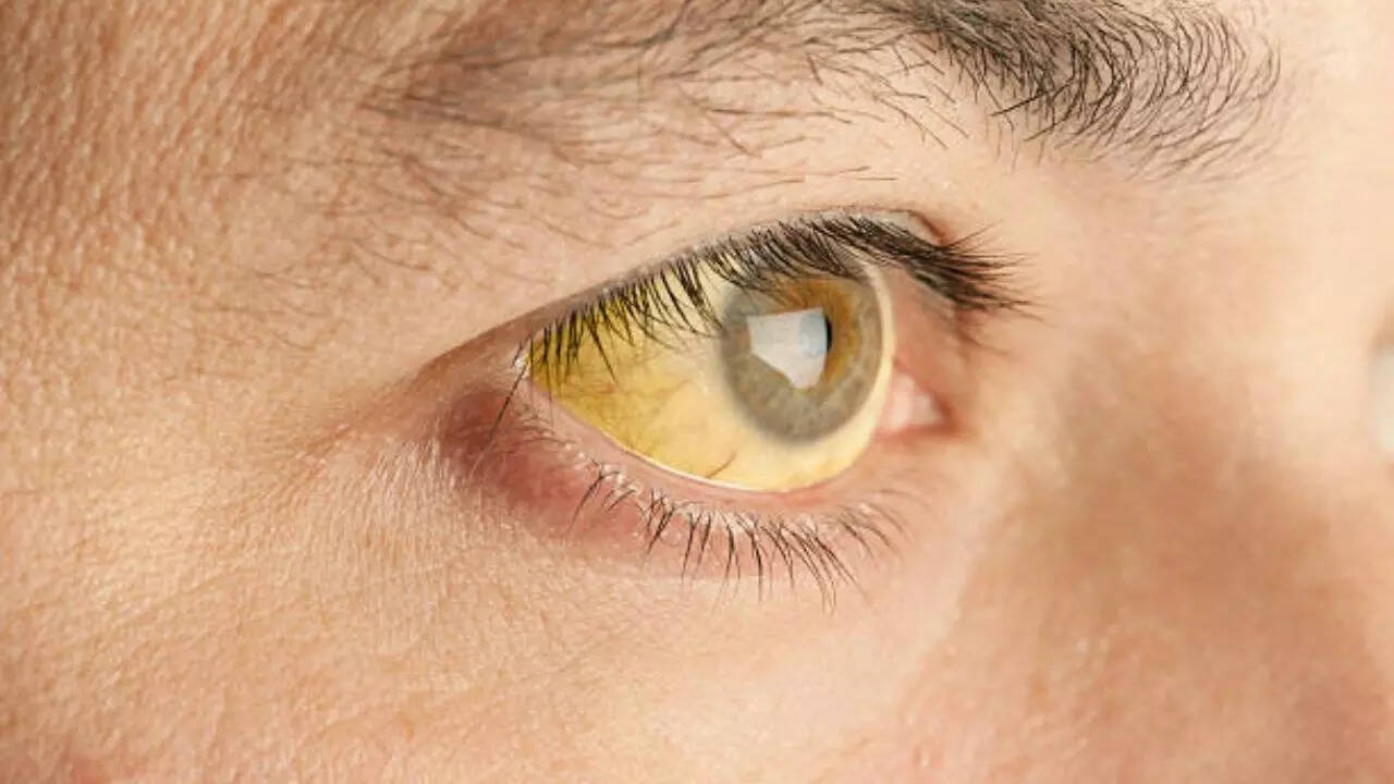 Liver damage starts silently: 7 lesser-known signs men and women must ...