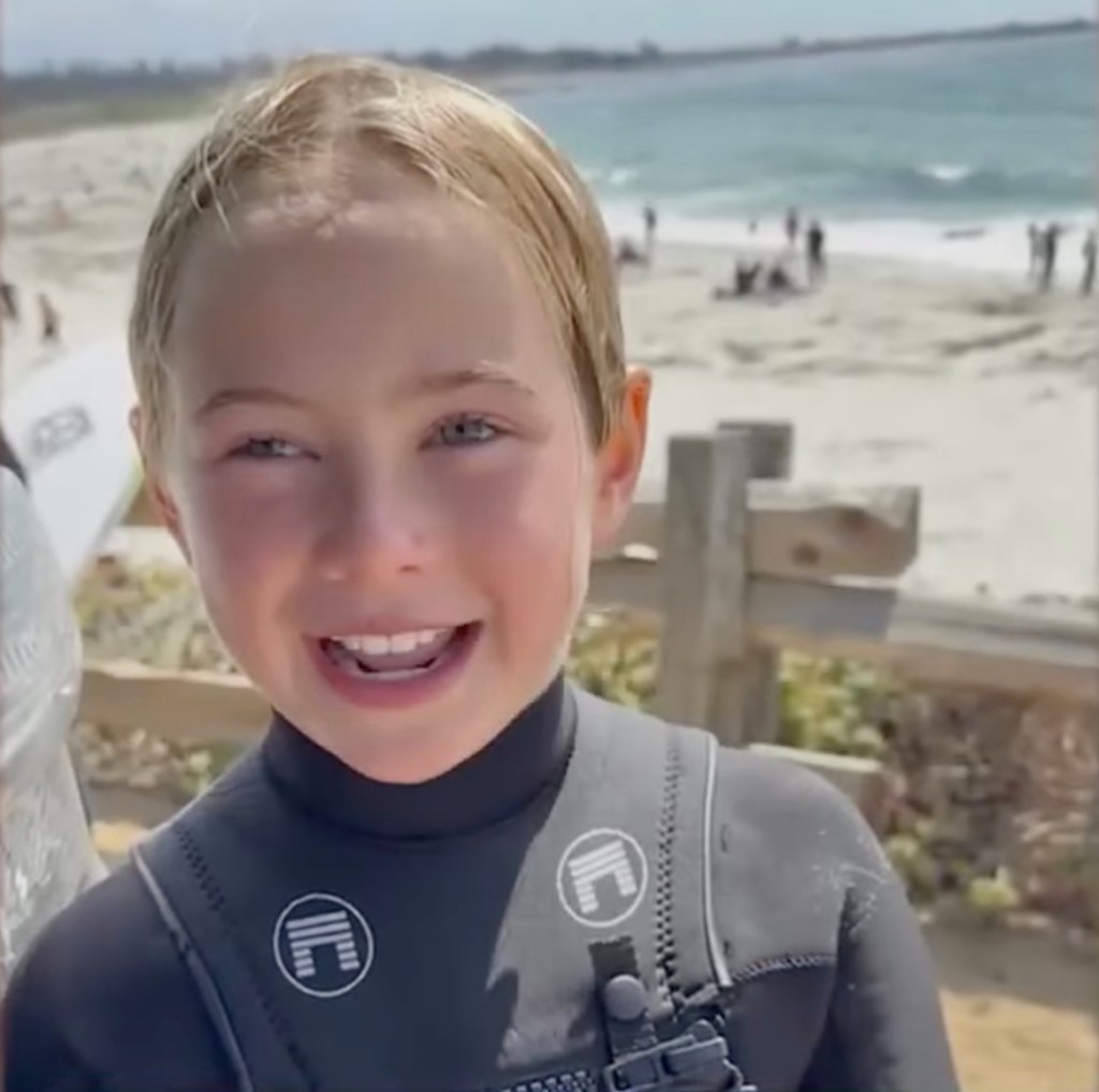 9-year-old girl bitten by sea lion in rare attack while at surf camp ...