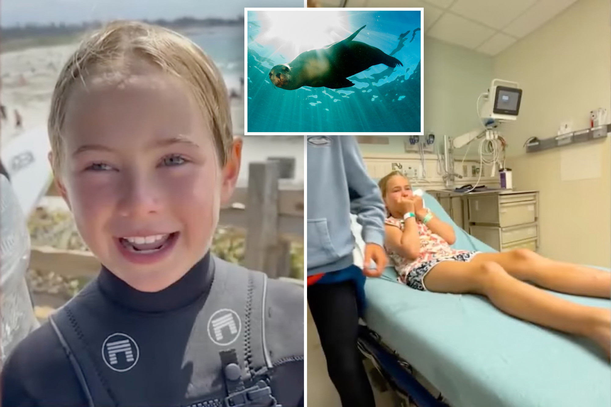 9-year-old girl bitten by sea lion in rare attack while at surf camp ...