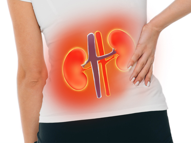 Kidney attack: What triggers it and how "normal-looking" symptoms can ...