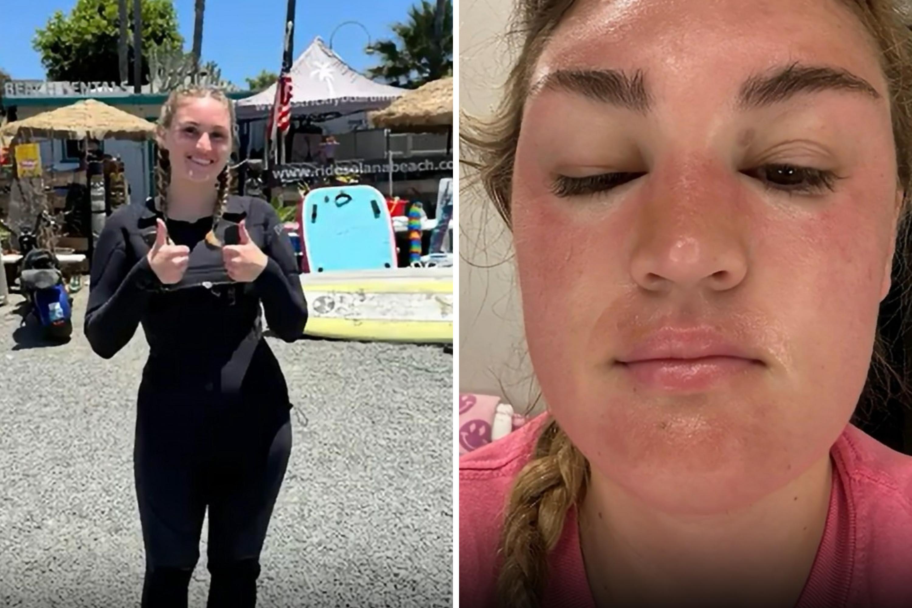 Woman spends day in the sea—wakes up terrified by her own reflection