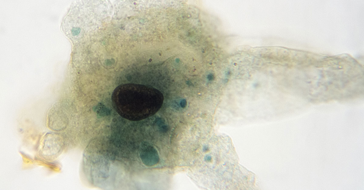 Tap Water Nasal Rinse Turns Into Nightmare as Brain-Eating Amoeba Kills ...