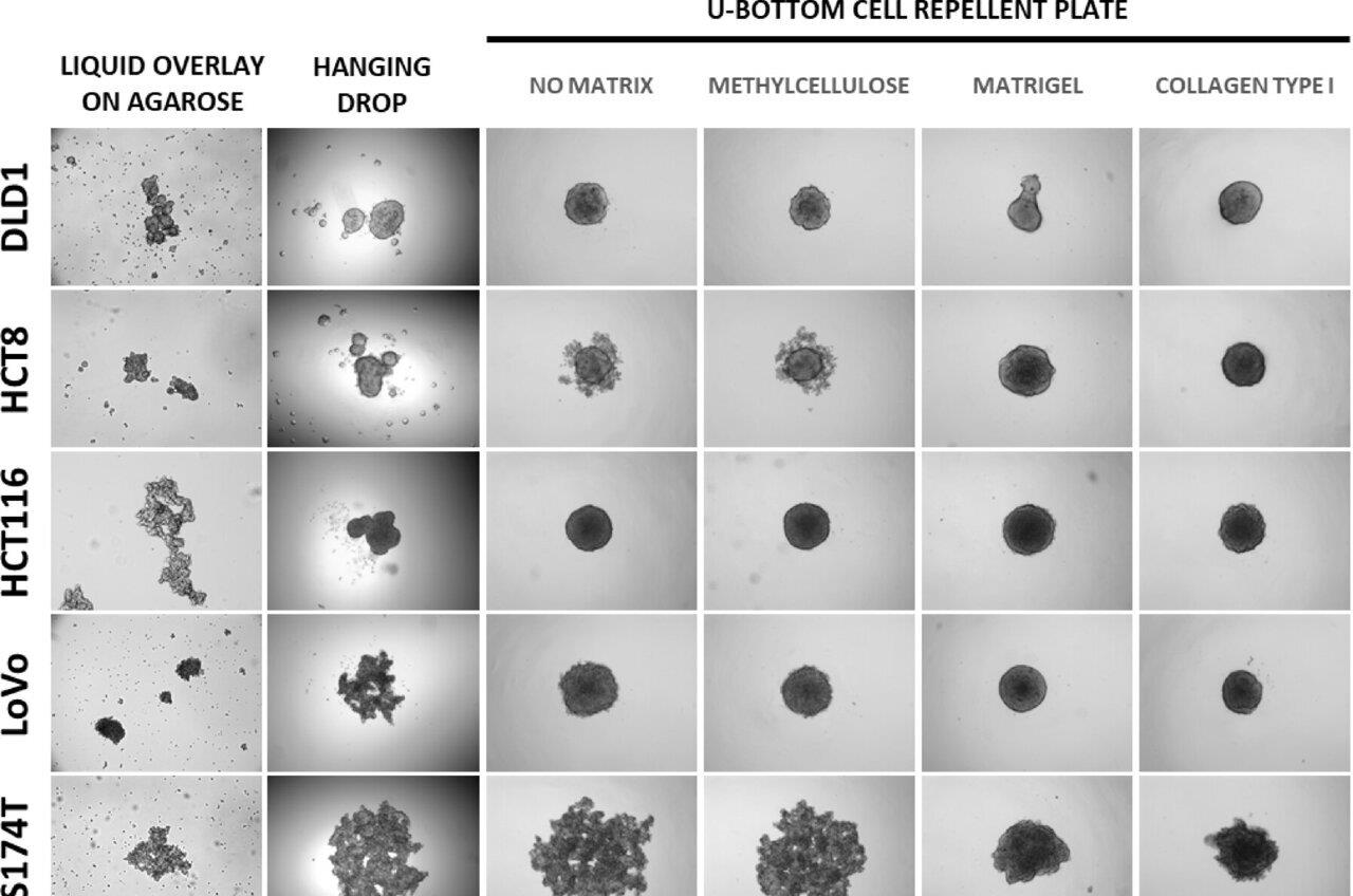 Colorectal cancer study expands and optimizes 3D tumor models