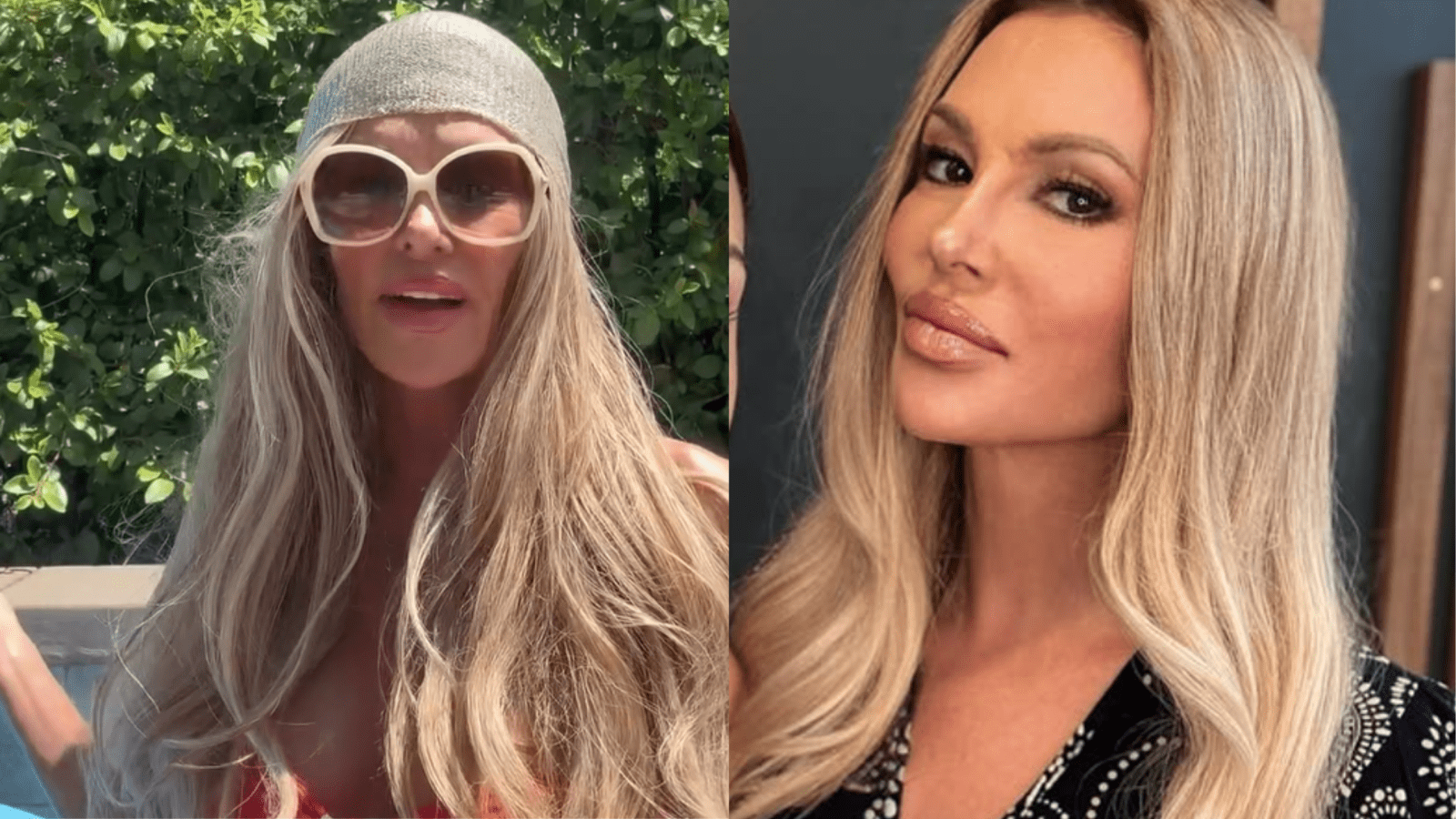 Real Housewives Star Brandi Glanville Suffers Painful Chemical Burns ...