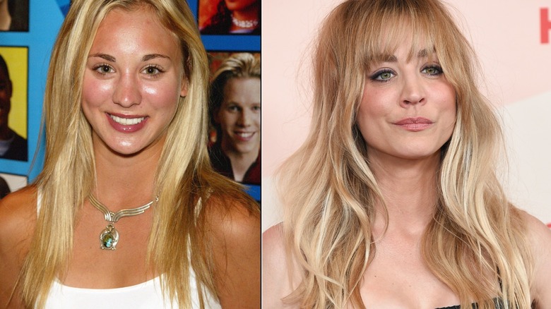 Kaley Cuoco Has Been Open About Her Plastic Surgery For A Long Time