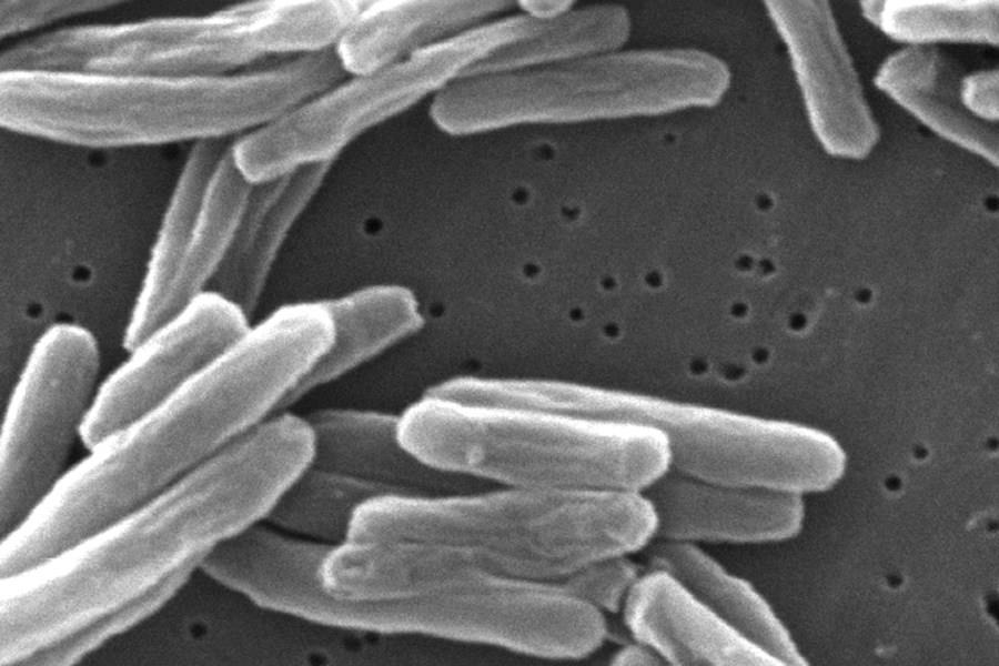Jackson County officials investigating tuberculosis case