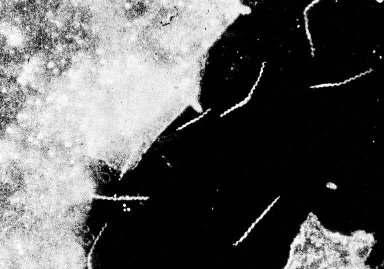 STDs are rampant in Mississippi. This one is now considered an epidemic.