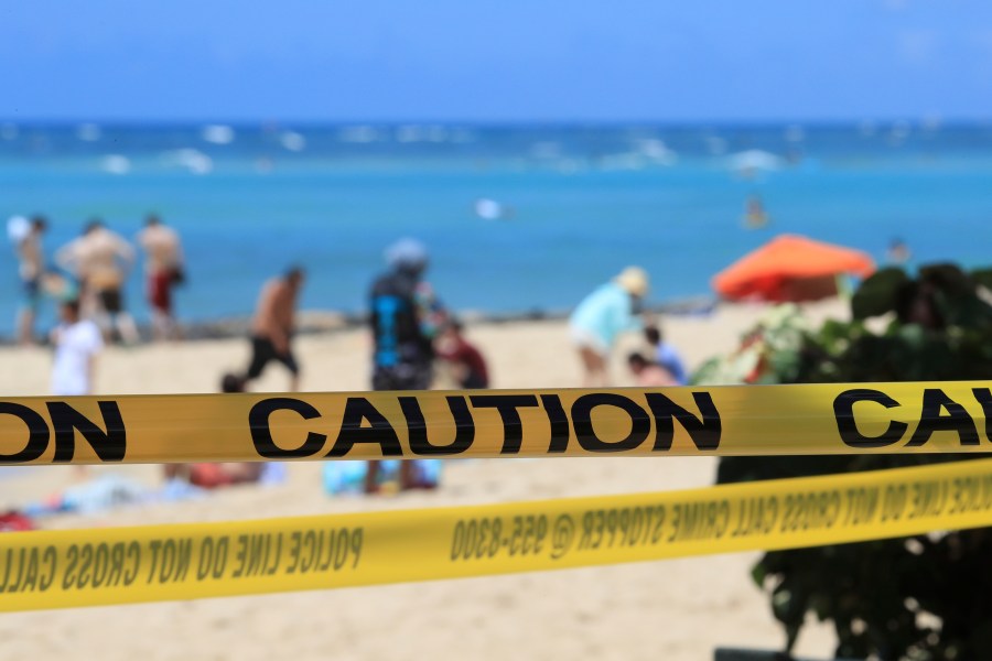 Mississippi has had three confirmed ‘flesh-eating bacteria’ cases in 2025