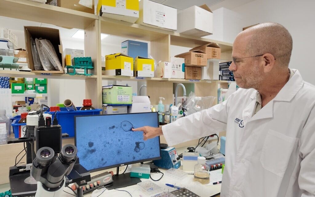 In a world breakthrough, Israeli researchers grow first long-term human ...