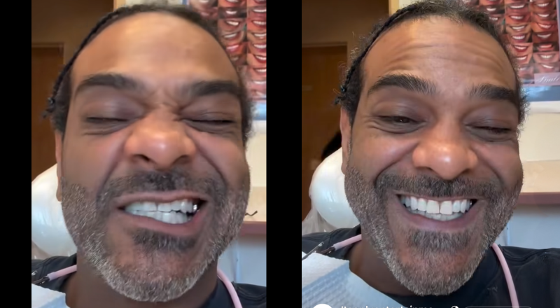 Jim Jones defends his natural teeth,“God gave me these” during recent ...