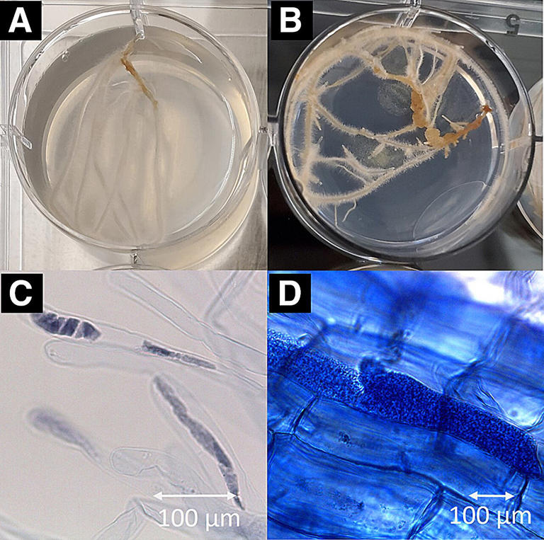 New study unlocks molecular defense against devastating potato pathogen