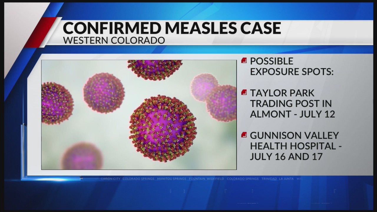 Measles cases reported in Western Colorado